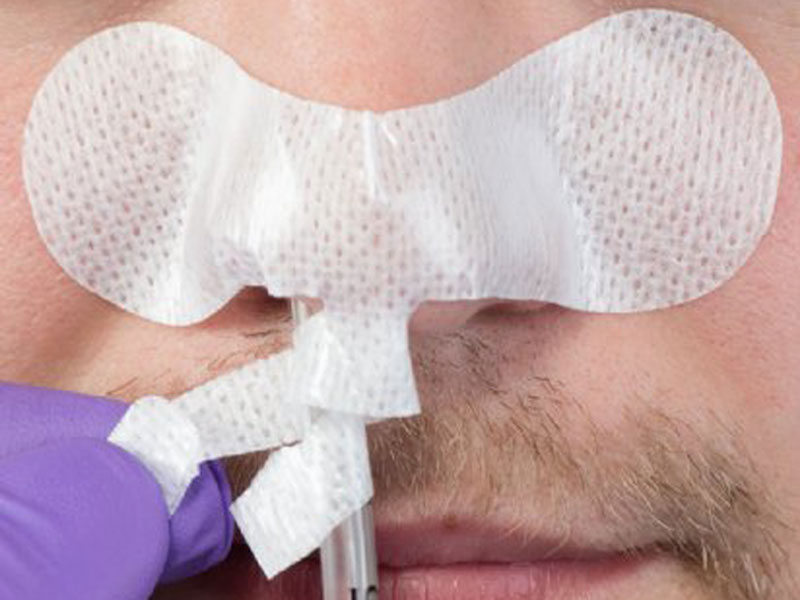 Securement Device Of Feeding Tubes And Other_Respiratory Tuber Fixture ...