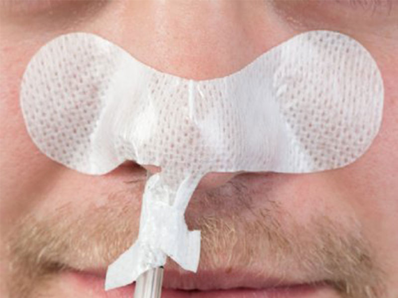 Securement Device Of Feeding Tubes And Other_Respiratory Tuber Fixture ...