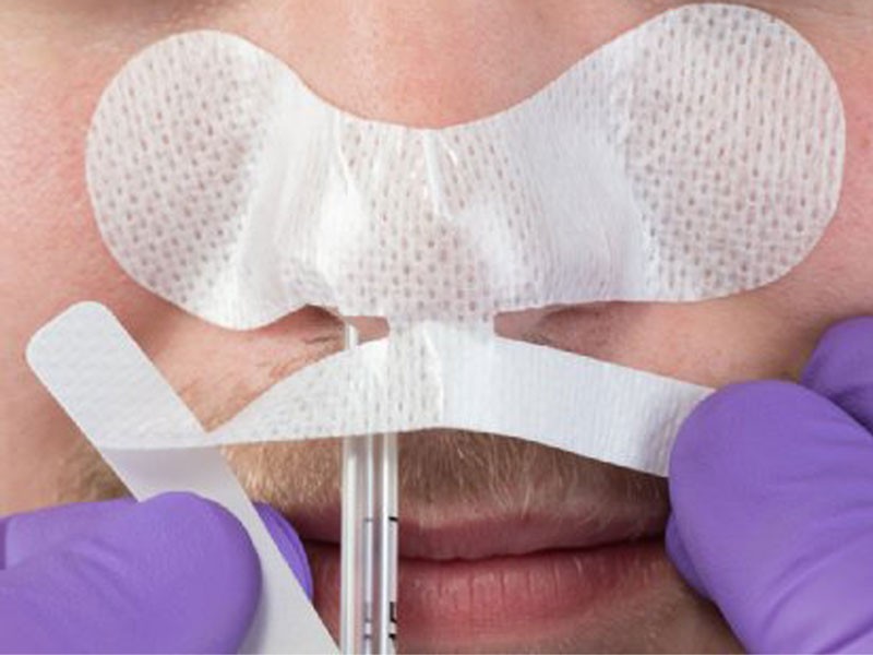 Securement Device Of Feeding Tubes And Other_Respiratory Tuber Fixture ...